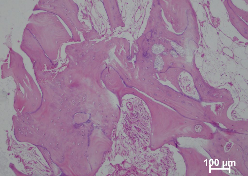 The Biologic Effects of Bond Apatite® in New Bone Formation in Osseous ...