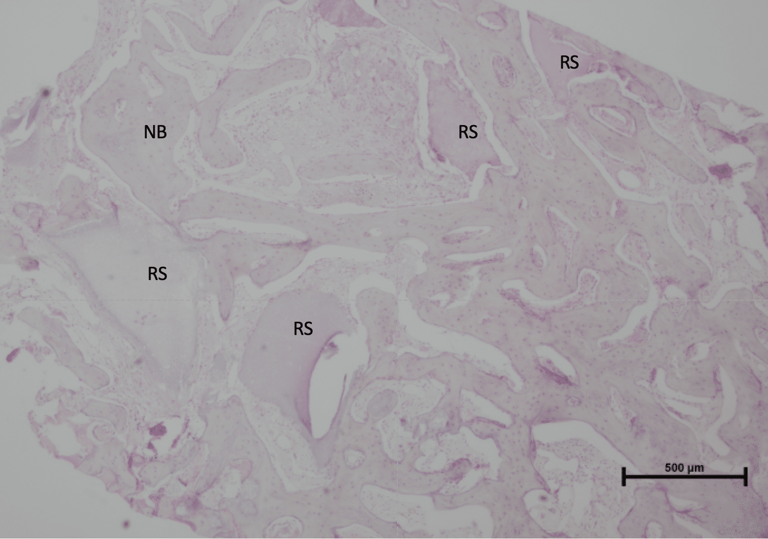The Biologic Effects of Bond Apatite® in New Bone Formation in Osseous ...