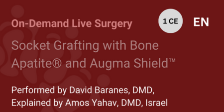 Socket Grafting with Bond Apatite® and Augma Shield™ - Live Surgery ...