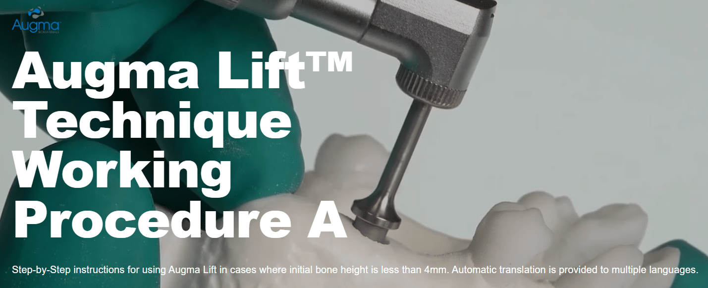 Augma Lift Complete Working Procedure - Scenario A - Augma Biomaterials