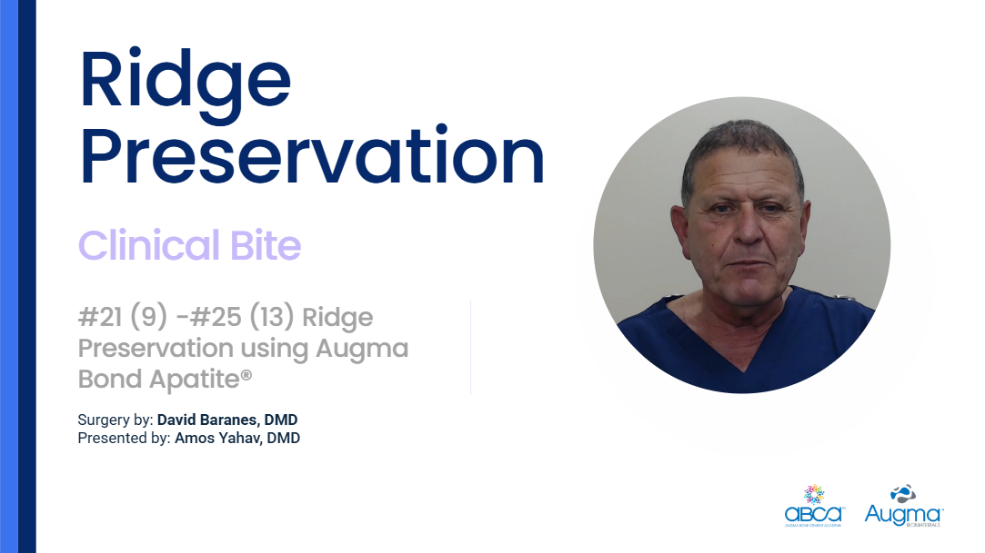 Ridge Preservation and Immediate Implant Placement, using Bond Apatite ...