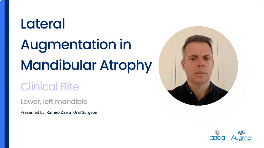 Lateral Augmentation in Mandibular Atrophy - Augma Biomaterials