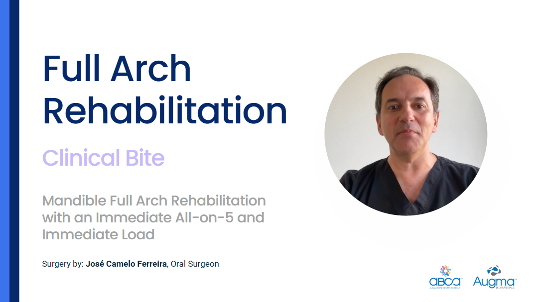 Mandible Full Arch Rehabilitation with an Immediate All-on-5 and ...